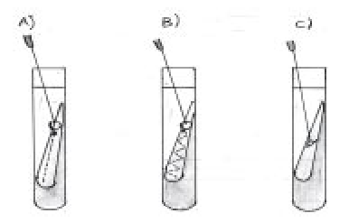 Microbiología 3-G Equipo #2: Técnicas y Métodos de estriado en caja y tubo