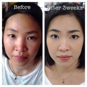 O2Max3 - Serum Terapi Kulit Terbaik Dunia - Terapi Hormon Nomor 1 Dunia