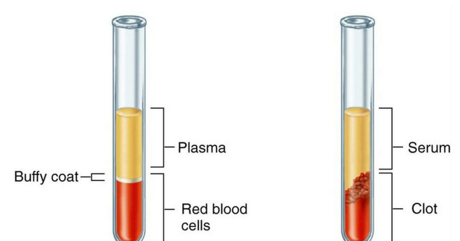 Difference between Blood serum and Blood plasma (Blood serum vs Blood ...