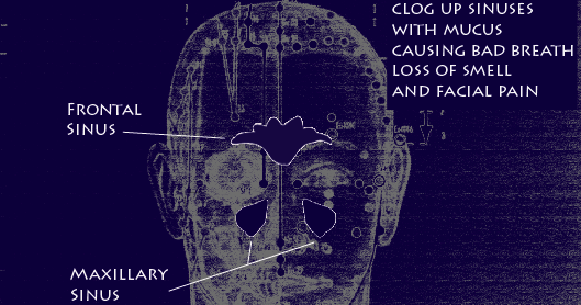 Acuthink Acupuncture For Sinusitis