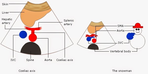Adult Emergency Medicine: Abdominal Aorta Ultrasound