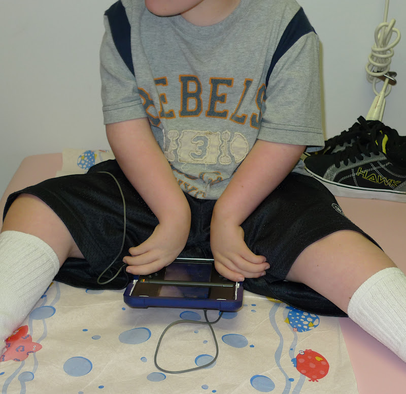 Arthrogryposis Arm Rotation | Congenital Hand and Arm Differences ...