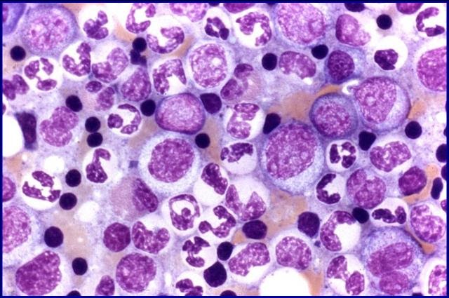 Histología Humana: Médula ósea