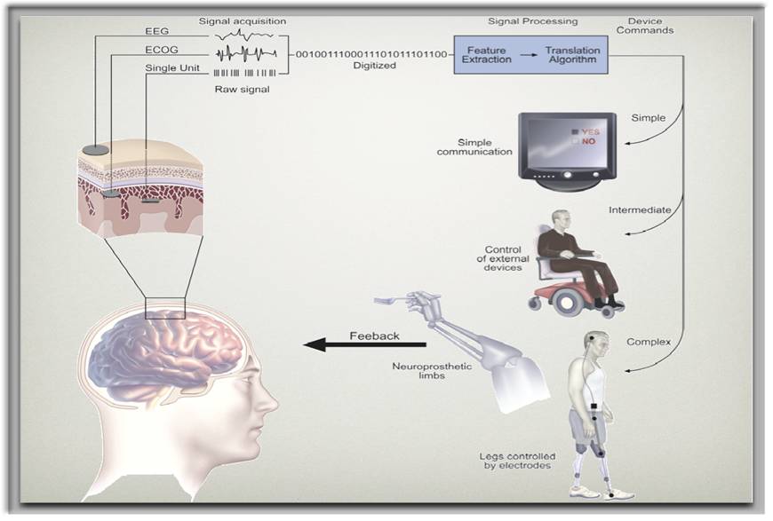 Brain Jack Image: Brain Computer Interface