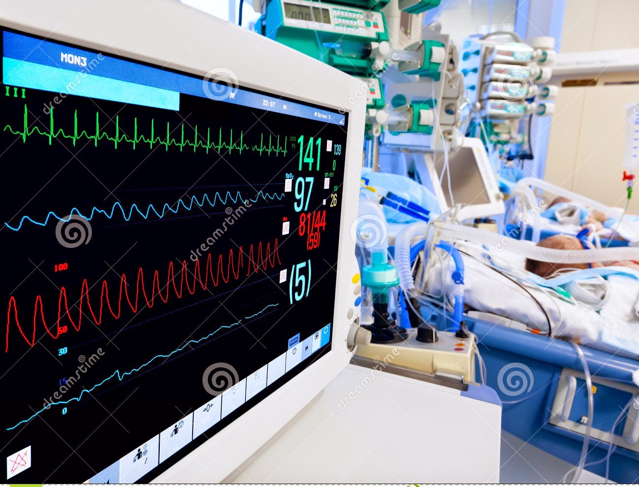 Sistem Informasi Manajemen ICU - Konsultasi SIMRS