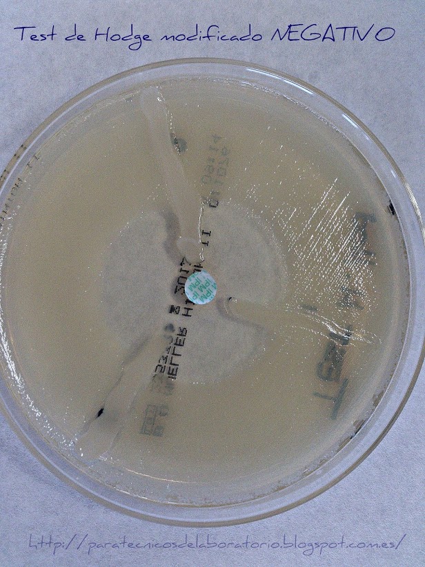 PARA TÉCNICOS DE LABORATORIO: Prueba de la Optoquina