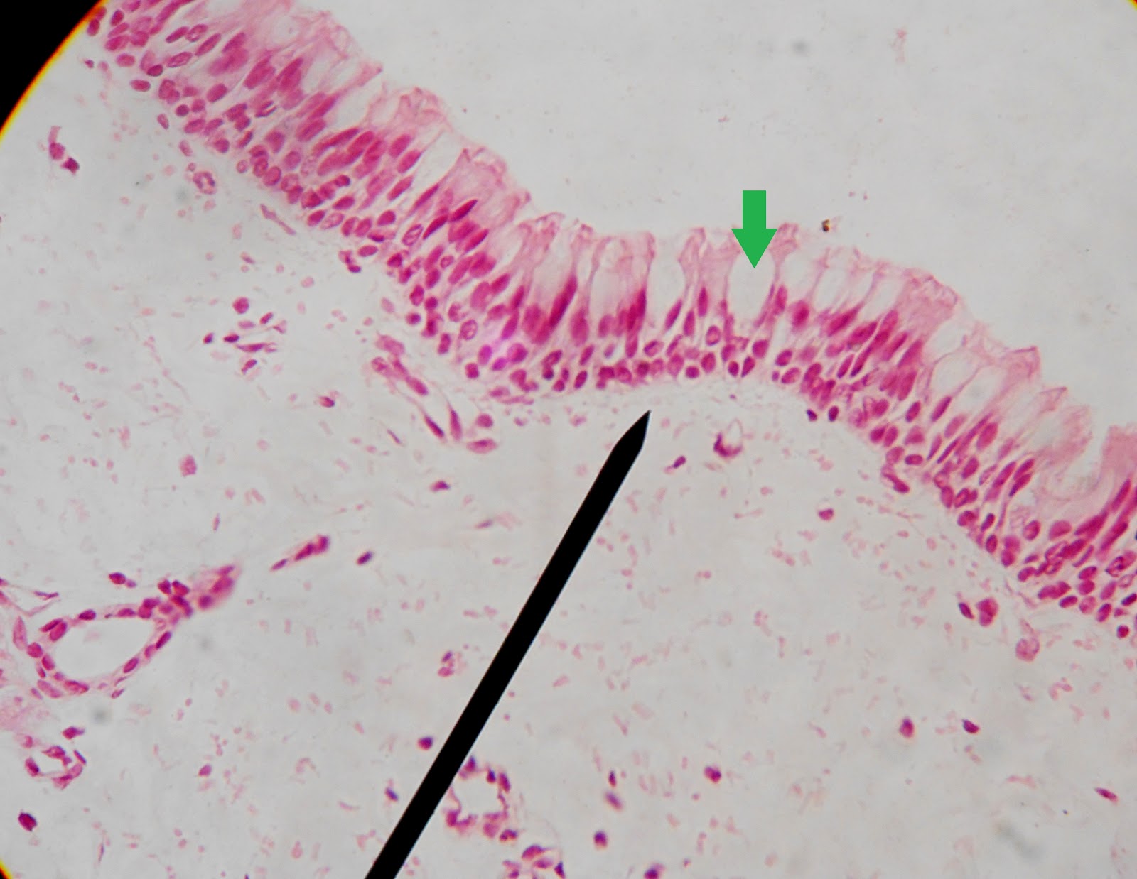Placas Histologicas : Traquea