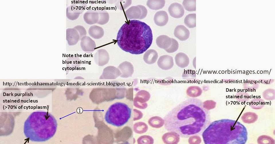 Haematology in a NutShell: Reactive/Atypical Lymphocytes