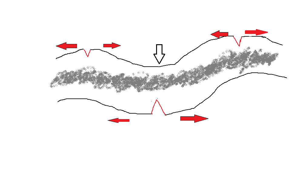 Priyanjith's Forensic Medicine & Medical Ethics: Mechanism of spider ...