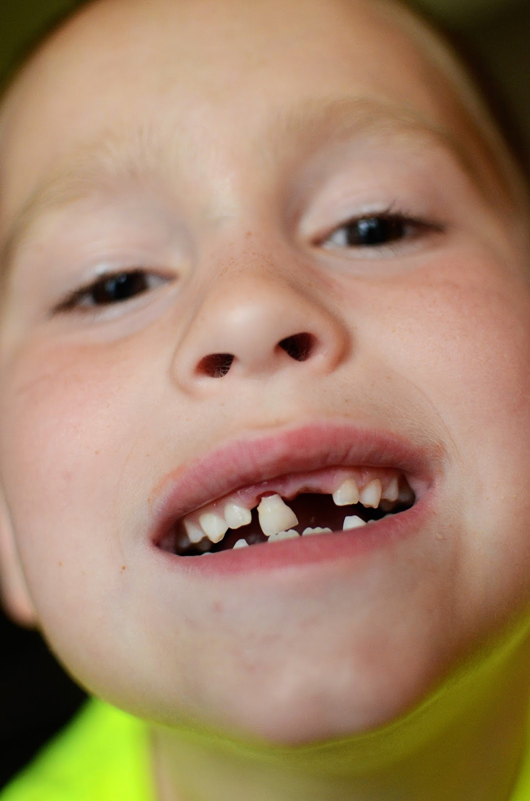 Adventures in Japan!: snaggletooth.