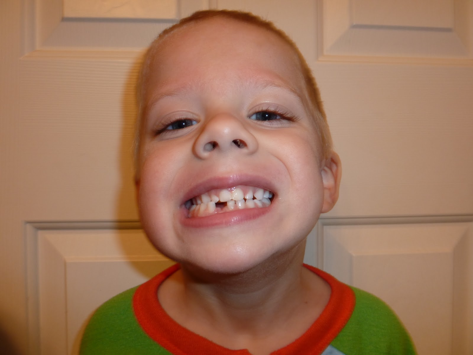 Joy In The Journey: Vaporized Children and A Missing Tooth