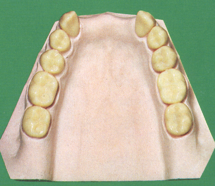Clasificación de kennedy