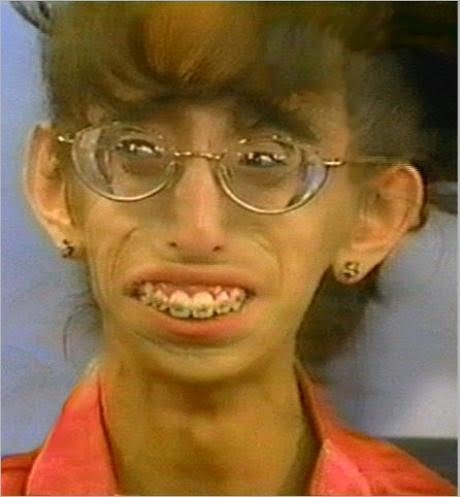 Plantão AFF: Quem é a pessoa mais feia do mundo?