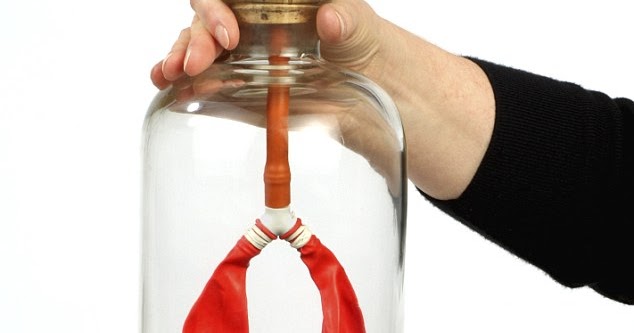 Bronchoscopic lung volume reduction procedures for COPD in 2017 ...