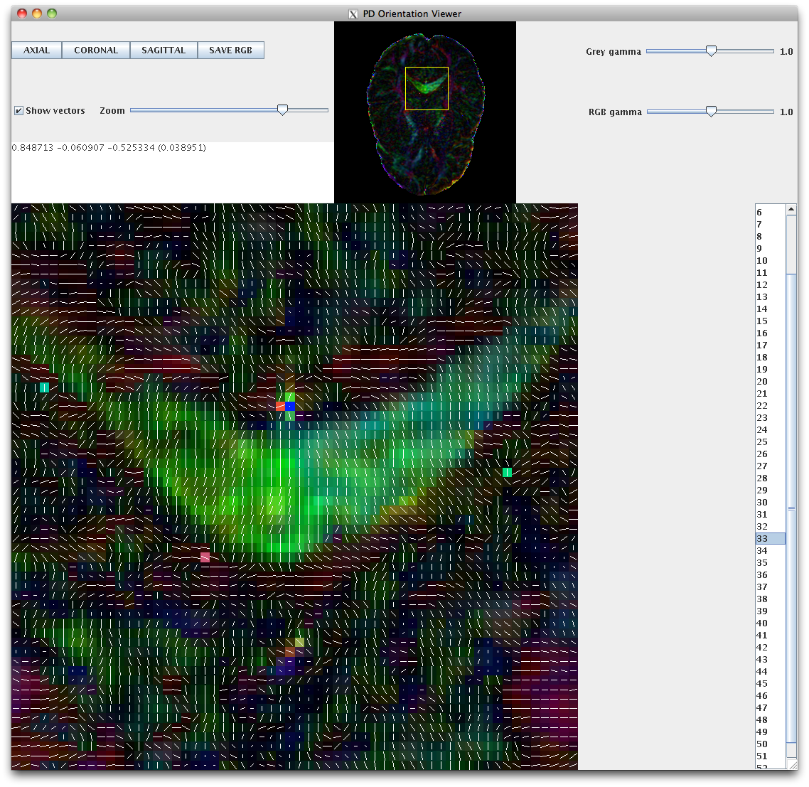 Dti Quality Control Part 2 Tensor Fitting Diffusion Imaging Introduction Tutorials And