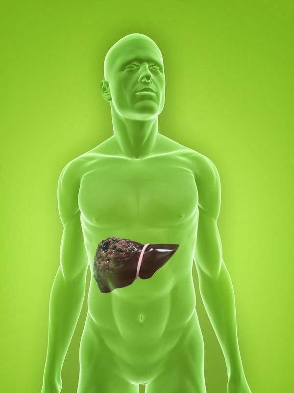 Hepatitis A - Definition, Pathophysiology, Transmission and Prevention ...