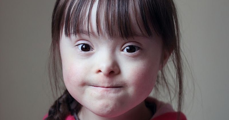 Experts Outline Down Syndrome's Developmental Milestones