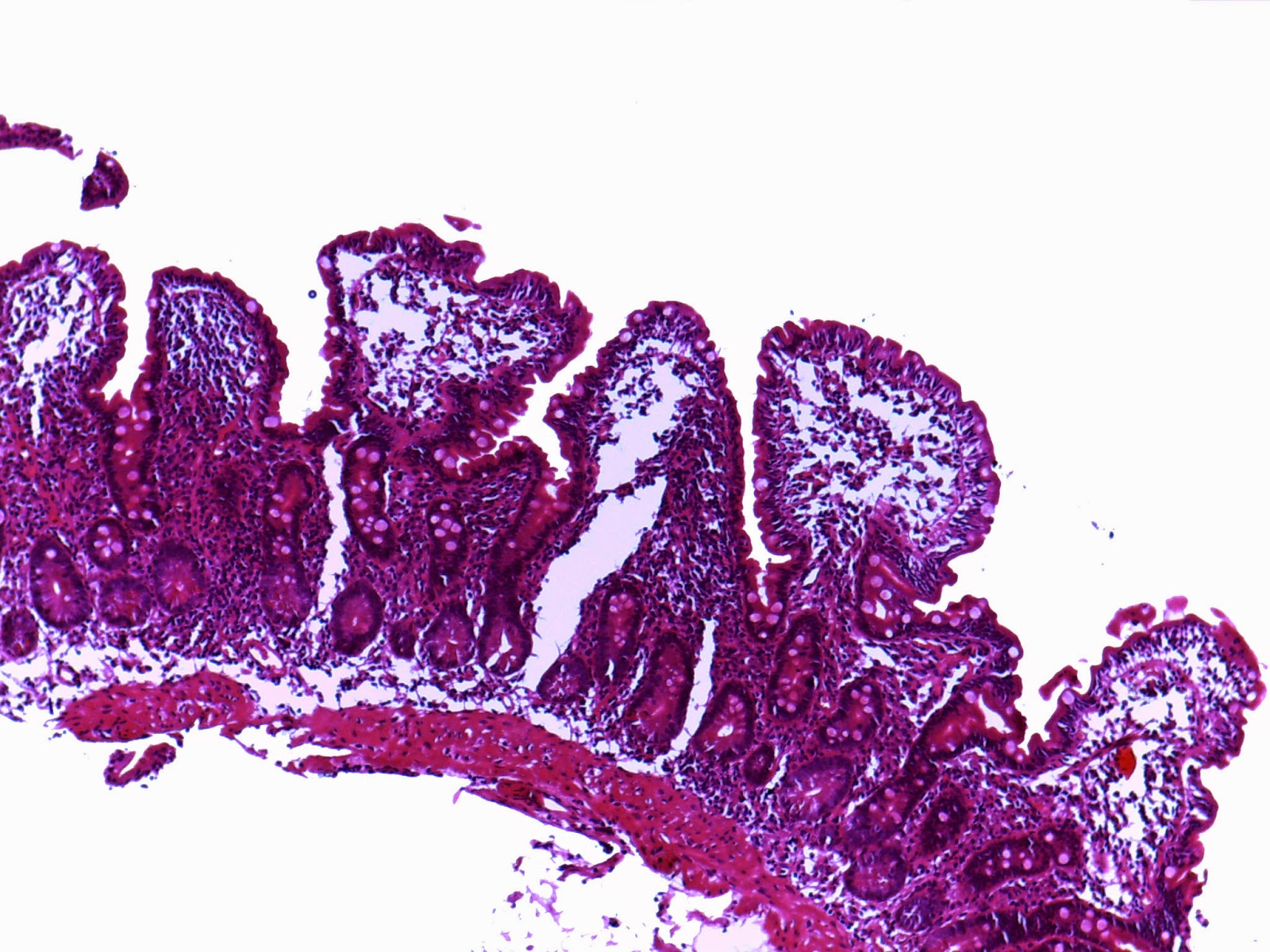 GASTROINTESTINAL AND LIVER HISTOLOGY PATHOLOGY ATLAS: DUODENUM: VILLOUS ...