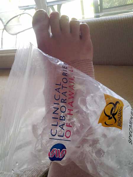 Artwife Needs a Life: Navigating Life With A Broken Ankle
