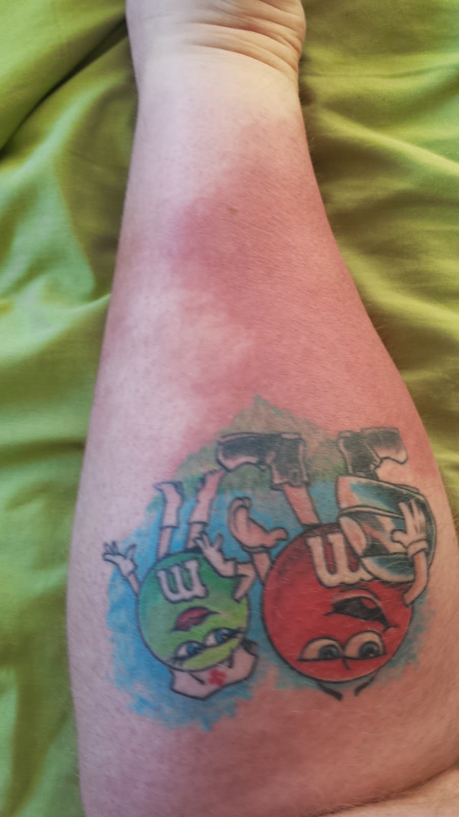 BubbaMike's Ramblings: Cellulitis (warning, graphic photos in this post)