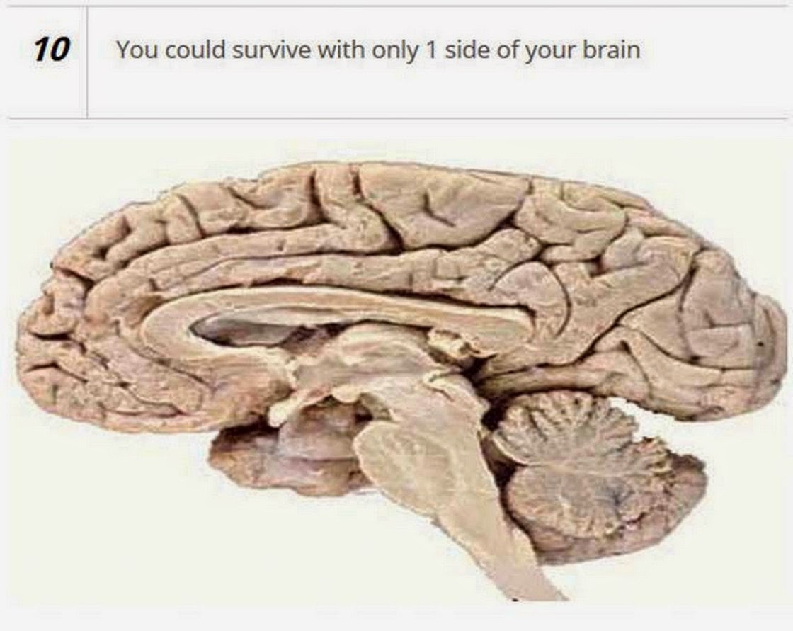 Chuck's Fun Page 2: Brain trivia - 25 images