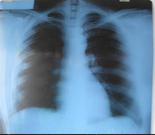 EL RINCÓN DE LA MEDICINA INTERNA. juanpedromacaluso@yahoo.com.ar ...