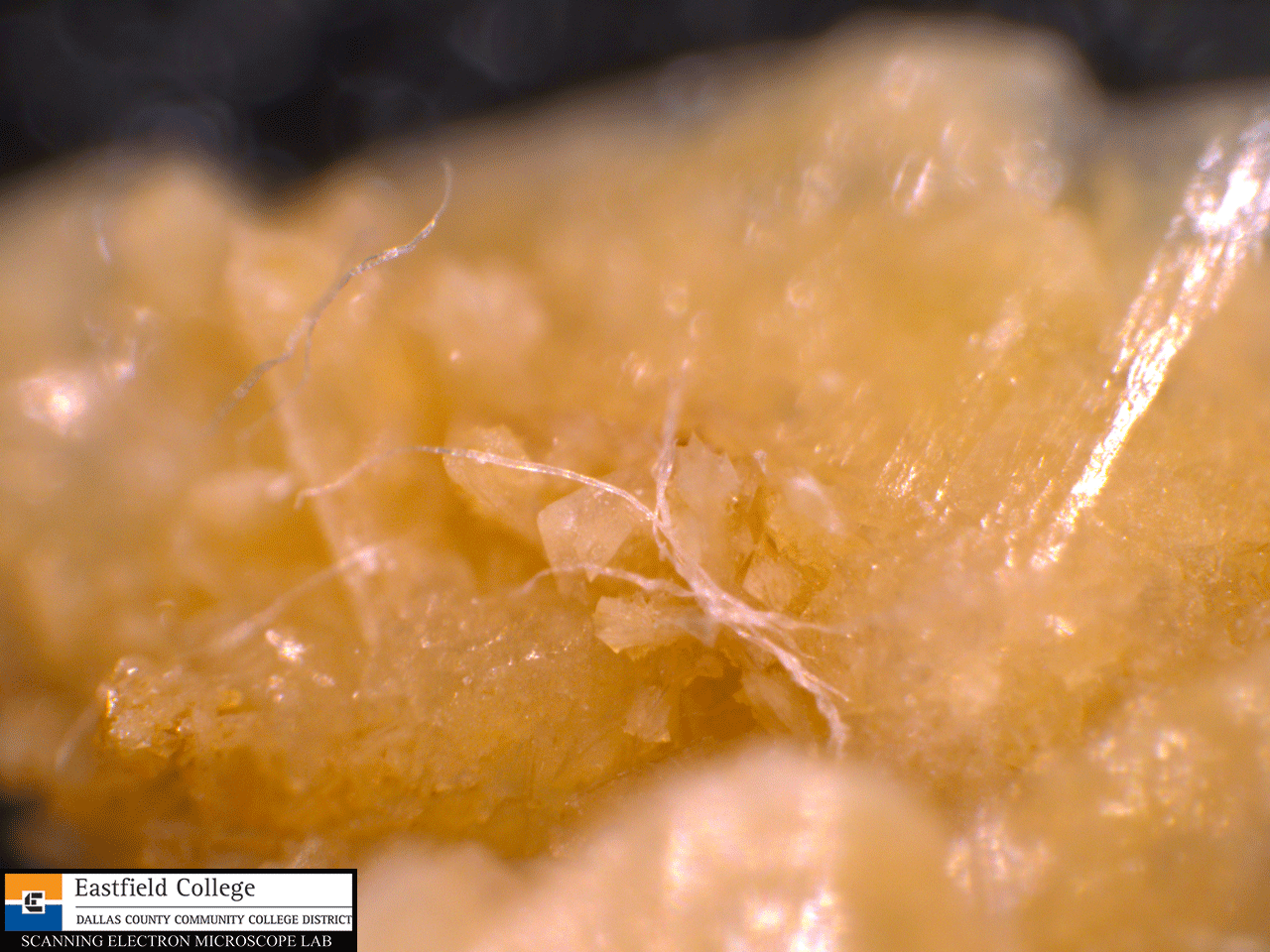 Scanning Electron Microscope Blog: A Kidney Stone - OUCH!!