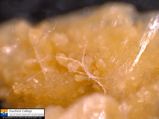 Scanning Electron Microscope Blog: A Kidney Stone - OUCH!!