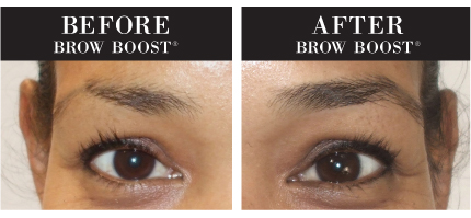 Mediskin: Wow Brows!