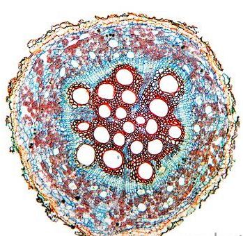Anatomi Batang (umbi) Ketela (Ipomoea batatas) - Blog Iqbal Ali