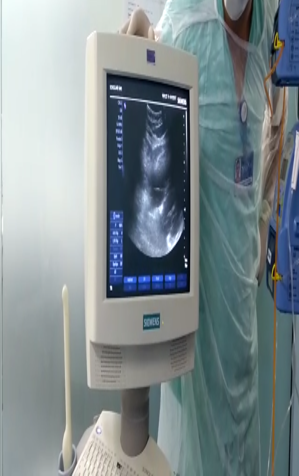 MEDICINA INTENSIVA CUSTOMIZADA : TROCA DE MARCAPASSO PROVISÓRIO EM ...