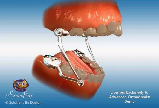 Poser Orthodontics Blog: August 2014