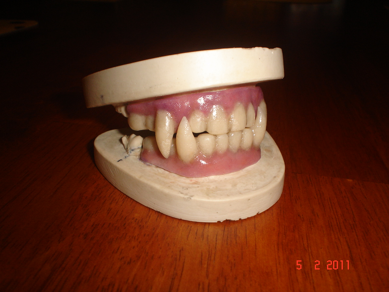Custom Teeth: Werewolf Design