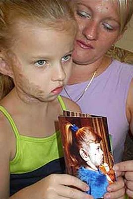 mutaciones geneticas: algunas victimas del desastre de chernobyl