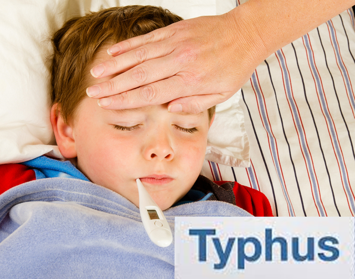 Mengenal Demam Tifoid (Typhus) dan Cara Mengatasinya - Share Everything
