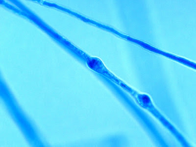 Fun With Microbiology (What's Buggin' You?): Trichophyton tonsurans