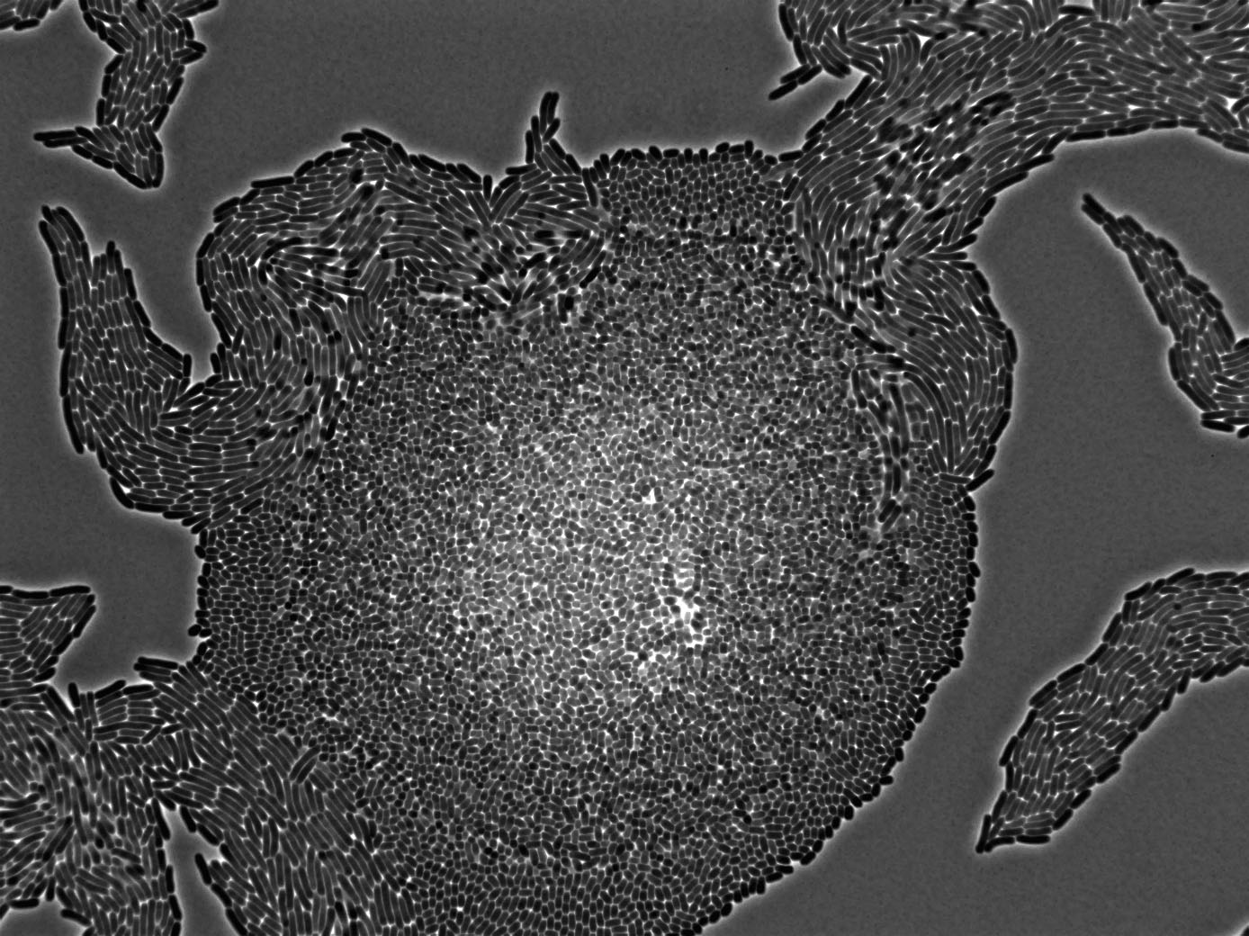 Of Bacteria and Men: Fluorescent bacteria under the microscope