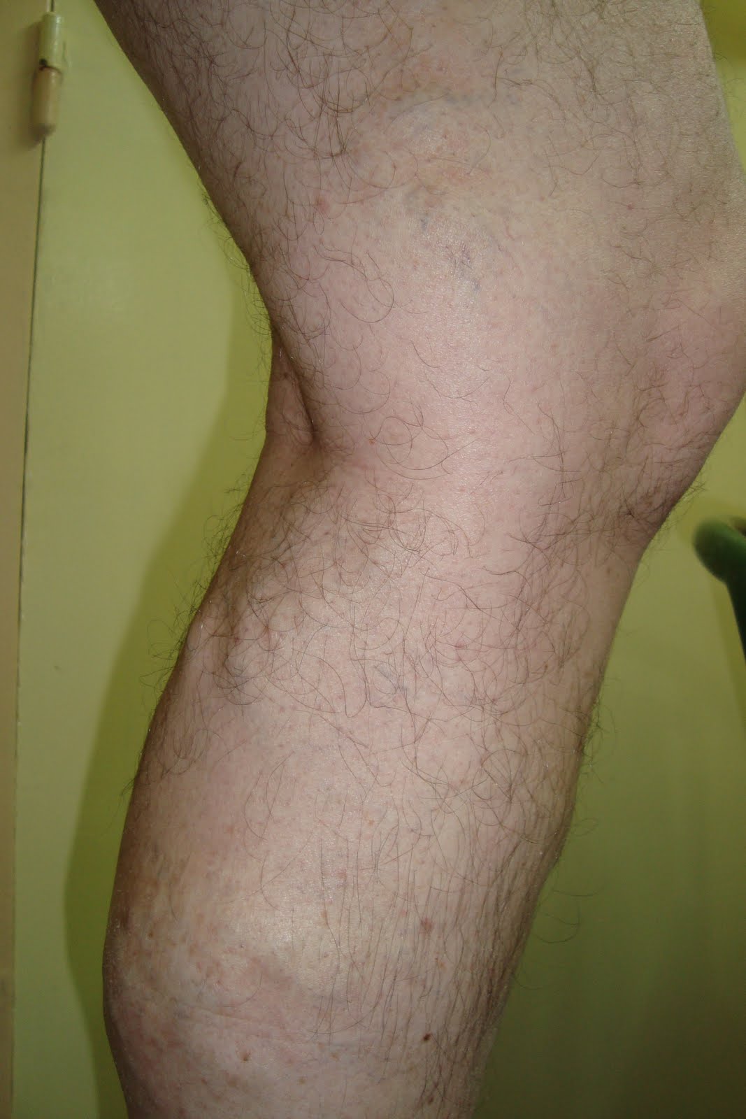 Cursos de Cirugía - Hospital Tornú: V CURSO TEÓRICO PRÁCTICO DE ...