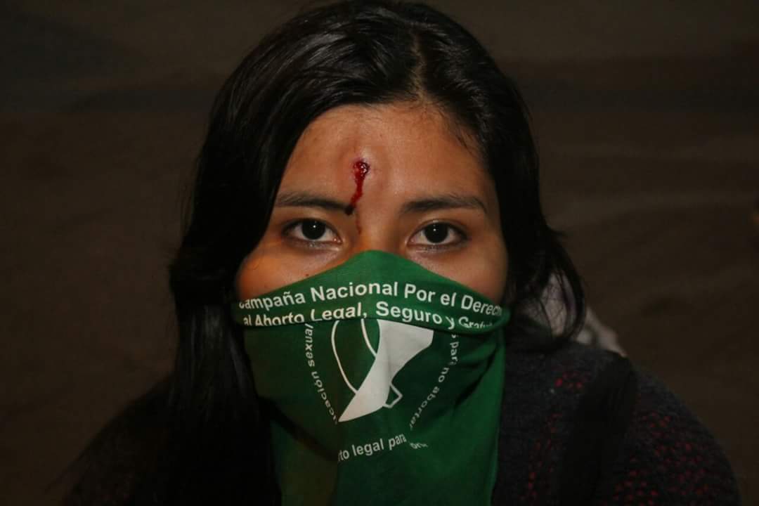 El Blog de José Rubén Sentís: con un balazo en la frente