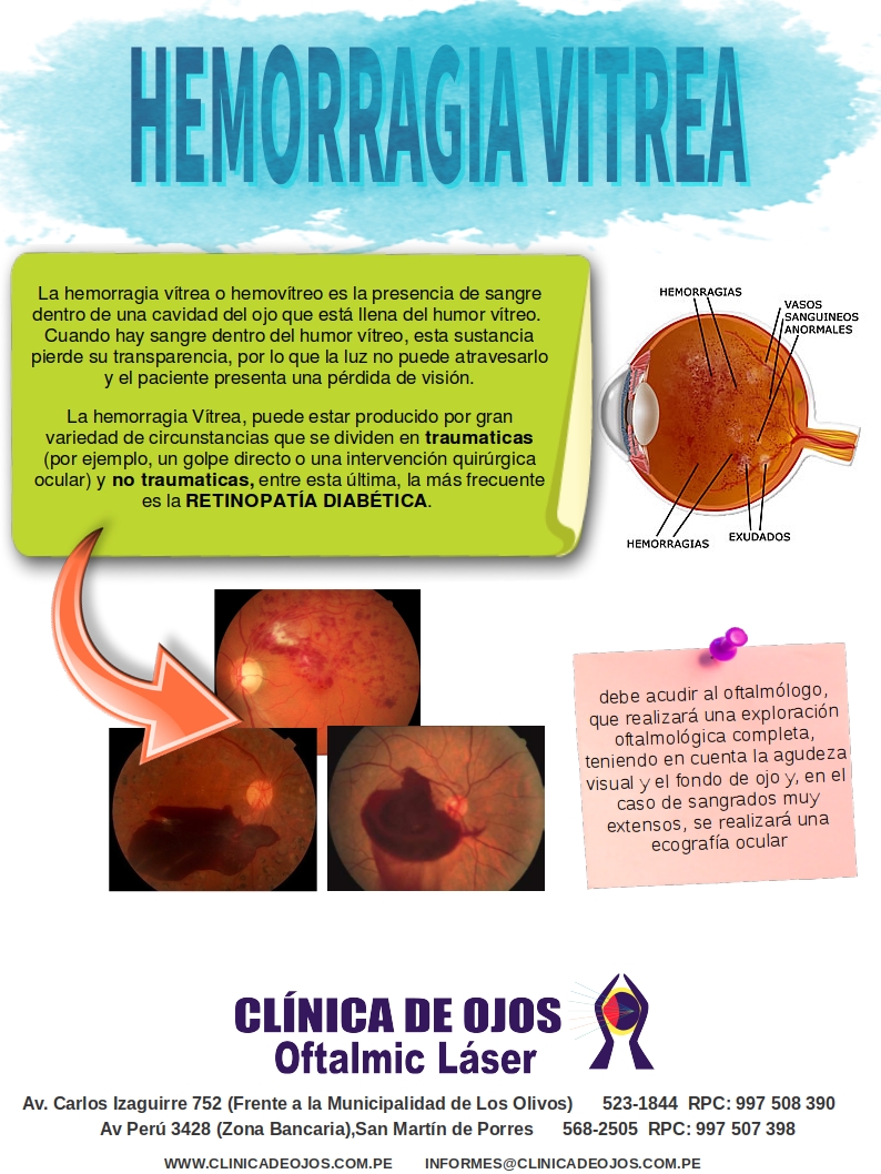 HEMORRAGIA VITREA