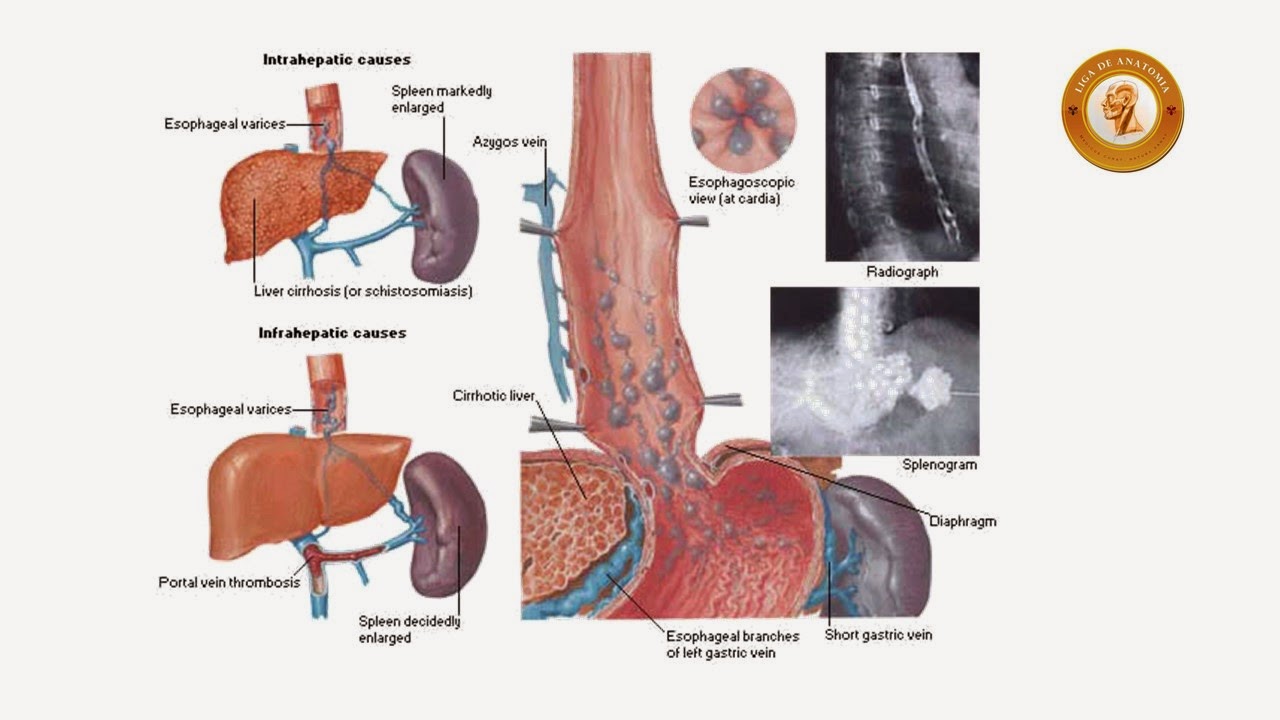 Liga de Anatomia ULBRA: ESÔFAGO