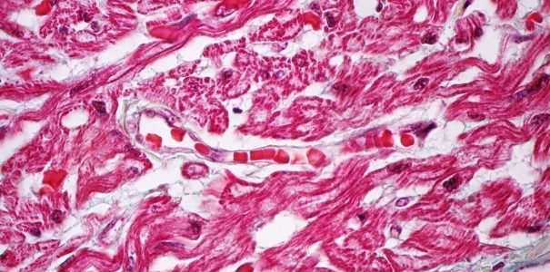 Avances en medicina T.5: ¿Es efectiva la quimioterapia? Aurora Martín ...