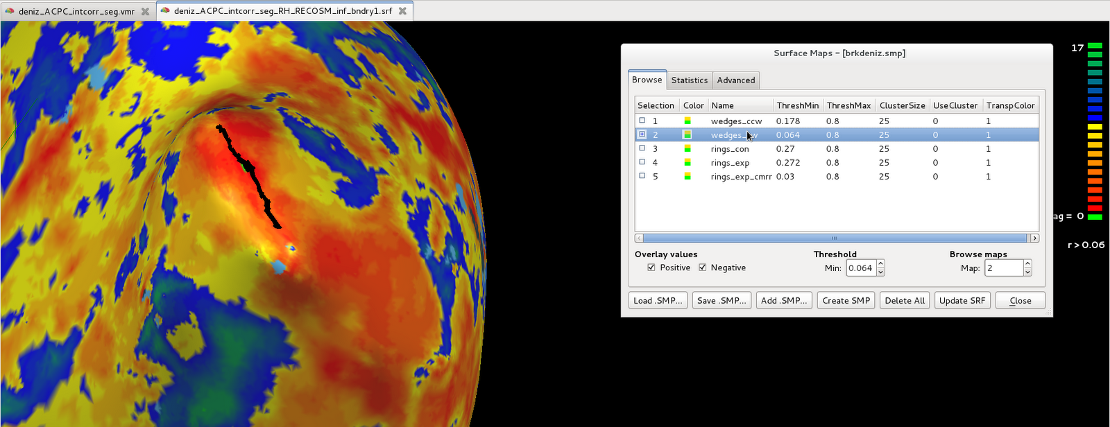 =Vision Group fMRI analysis guide=: Ring Stimulation with Single Shot ...