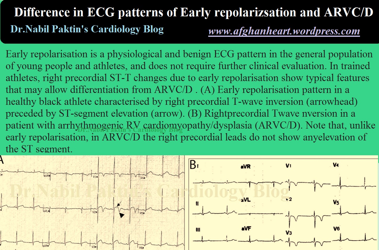 Dr.Nabil Paktin's Journal of Cardiovascular Medicine Blog ژورنال ( قلب ...