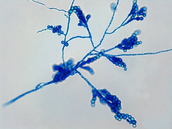 Fun With Microbiology (What's Buggin' You?): Scopulariopsis brevicaulis