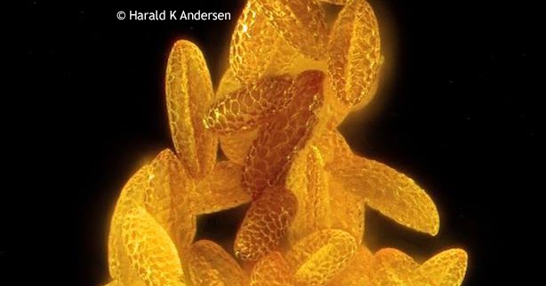 Microscope World Blog: Lily Pollen under Microscope