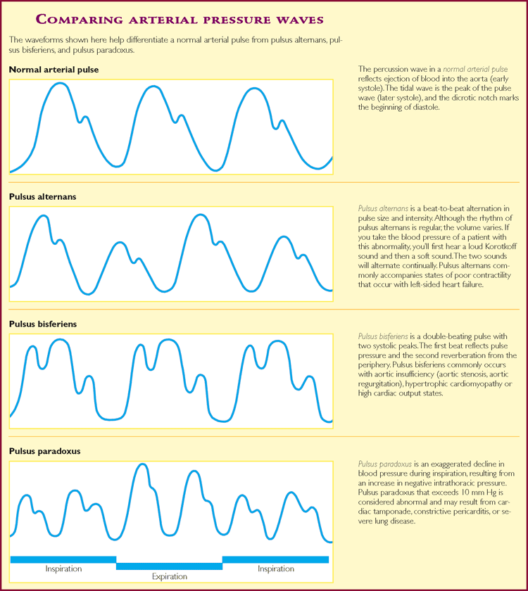 Long Life Learning: Bermacam Denyut Nadi (Pulsus)