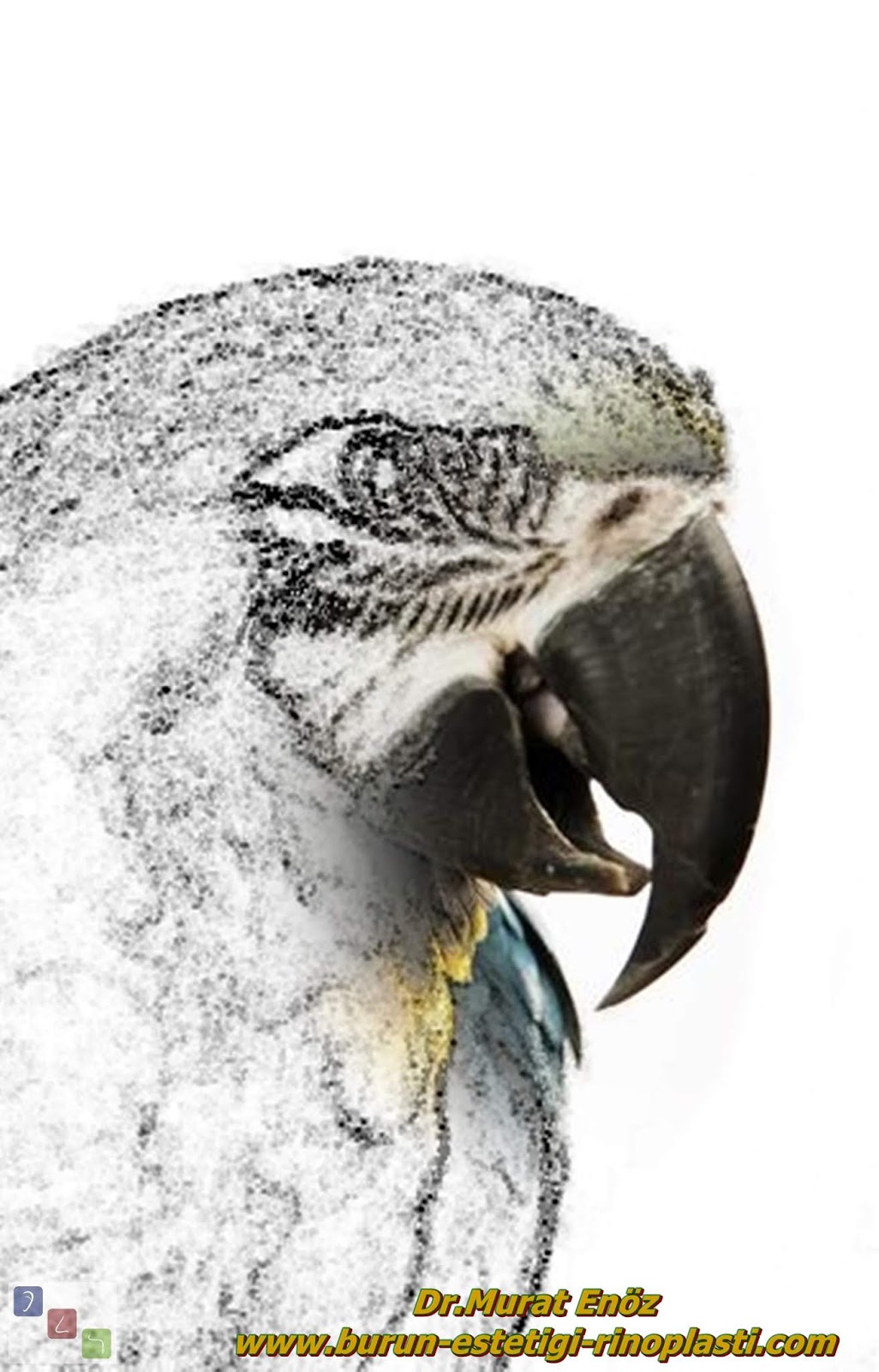 Health Zone Turkey: Pollybeak Deformity - Definition, Causes ...