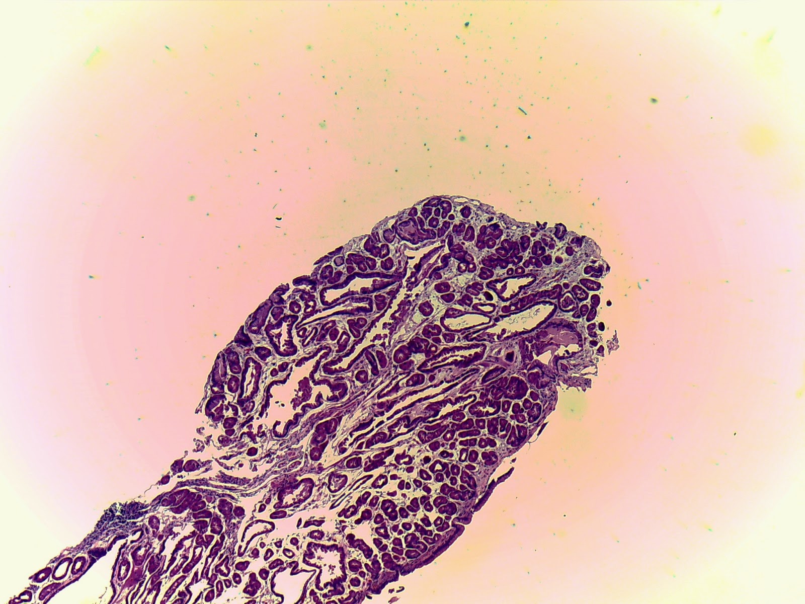 GASTROINTESTINAL AND LIVER HISTOLOGY PATHOLOGY ATLAS: STOMACH: FUNDIC ...
