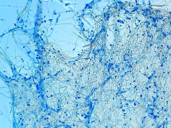 Fun With Microbiology (What's Buggin' You?): Sepedonium species